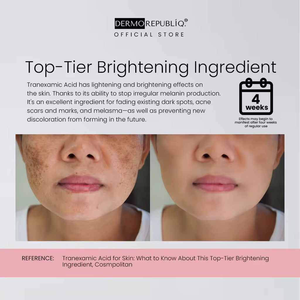 Dermo Republiq Serum 10% Niacinamide + 3% TRANEXAMIC Acid + 2% Alpha A ...