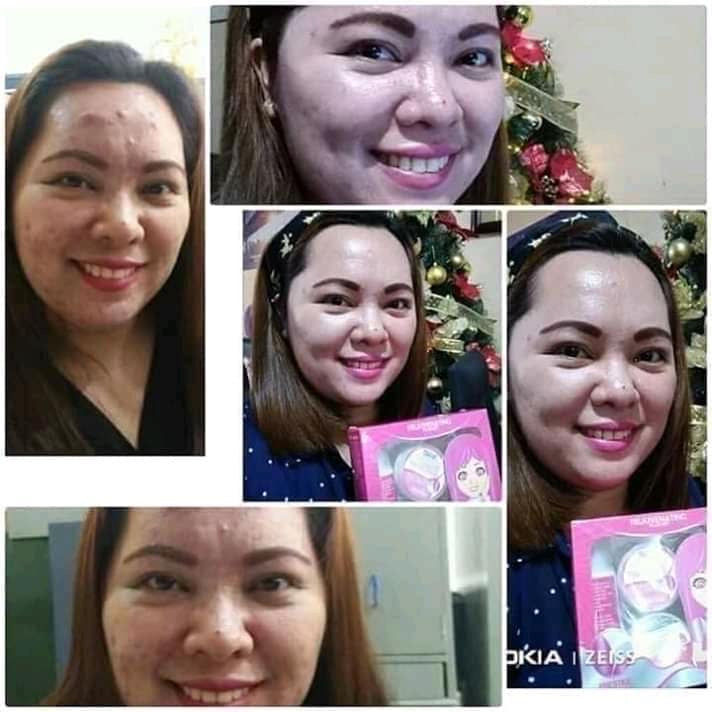 Prestige Rejuvenating set (Pink box) – My Care Kits