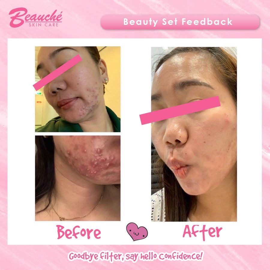Beauche Beauty Set (Dark pink) – My Care Kits